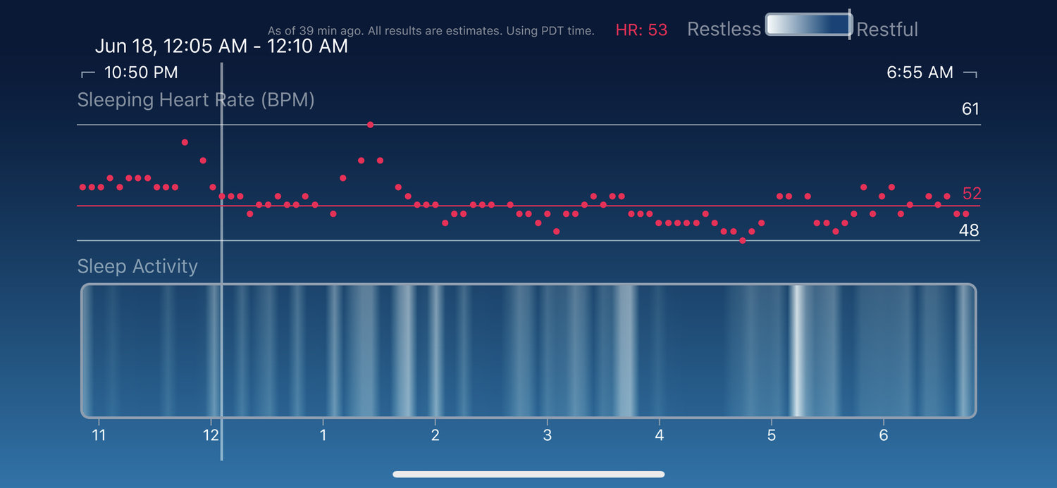 SleepWatch gets a new Sleep Pattern Graph — SleepWatch Blog